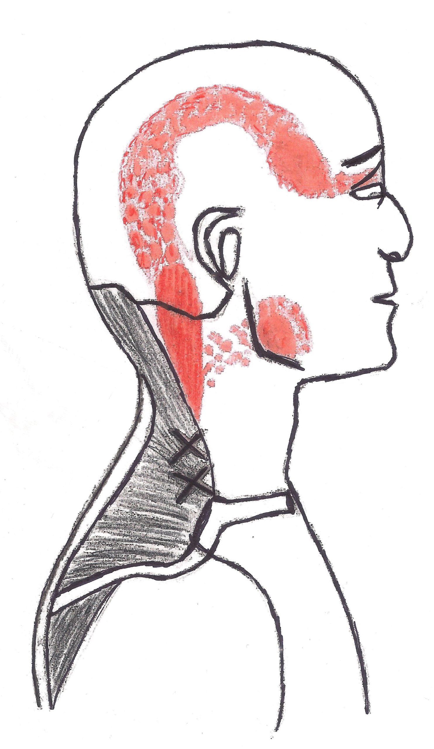 Triggerpunkt-Therapie - Physiotherapie am Haggen